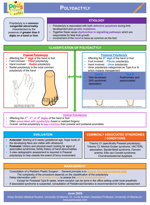 Polydactyly | PedsCases